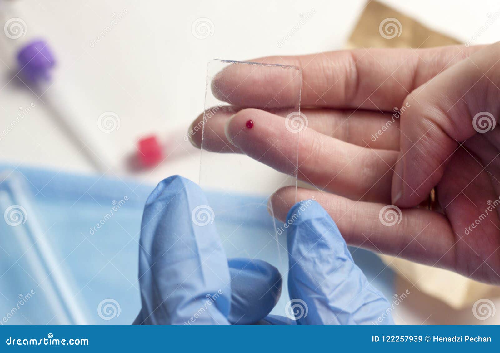Blood Sampling from the Finger, Close-up, Hand, Blood Finger Stock ...