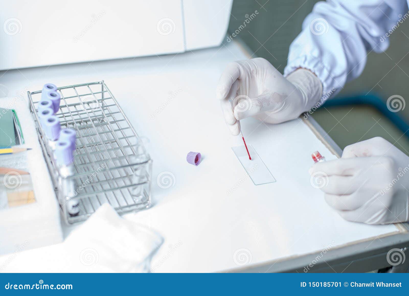 Blood Sampling with Needle for Analysis Stock Image - Image of bank ...