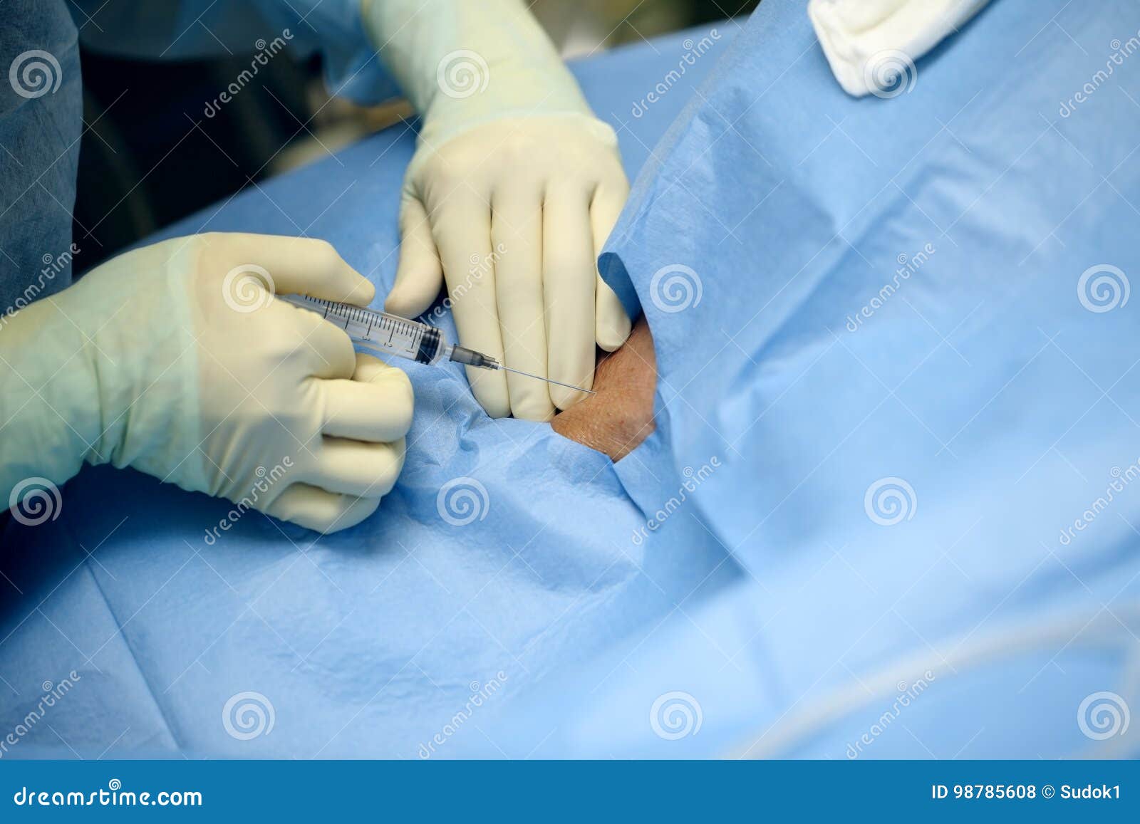 Blood Sampling in the Operating Room Stock Photo - Image of clinic ...