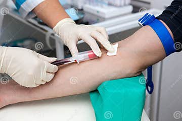 Blood Sampling Procedure for Analysis Stock Photo - Image of ...