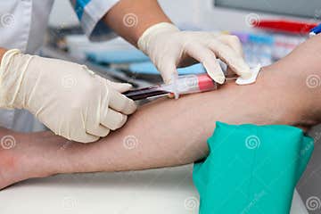 Blood Sampling Procedure for Analysis Stock Image - Image of laboratory ...