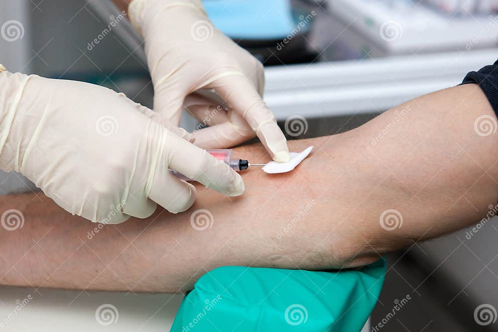 Blood Sampling Procedure for Analysis Stock Image - Image of donation ...