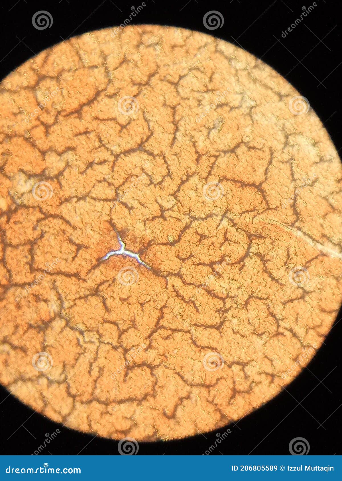 The Texture of a Blood Cell Stock Image - Image of microscope, cells ...