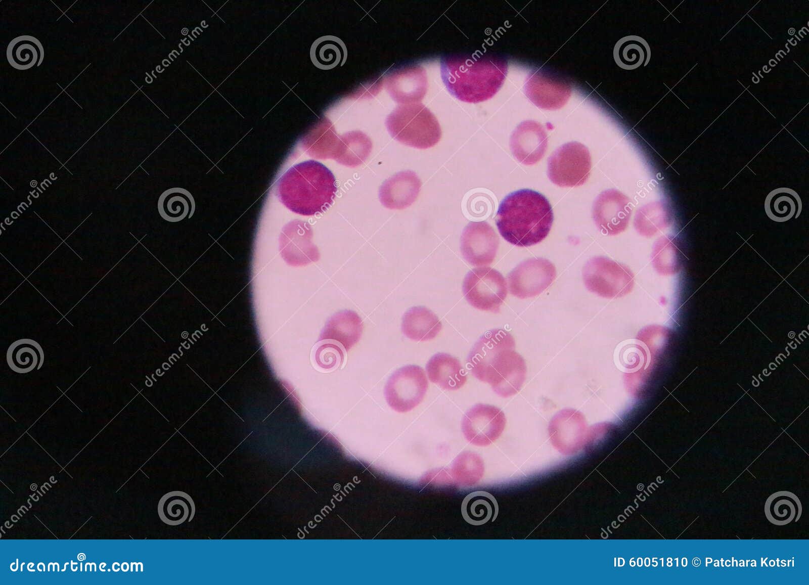 Blood smear stock photo. Image of white, cells, neutrophil - 60051810