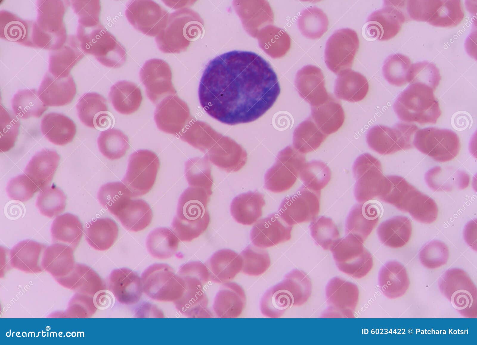 Blood smear stock photo. Image of hematology, blood, hemophilia - 60234422
