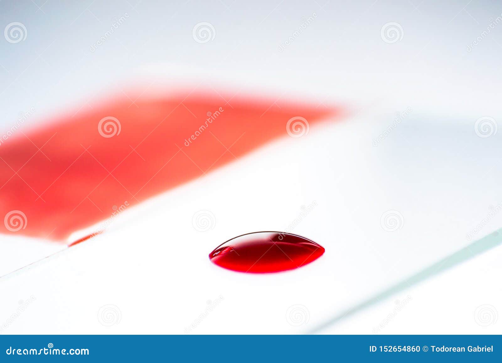 Blood Smear for Haematology Microscopic Examination Stock Photo - Image ...