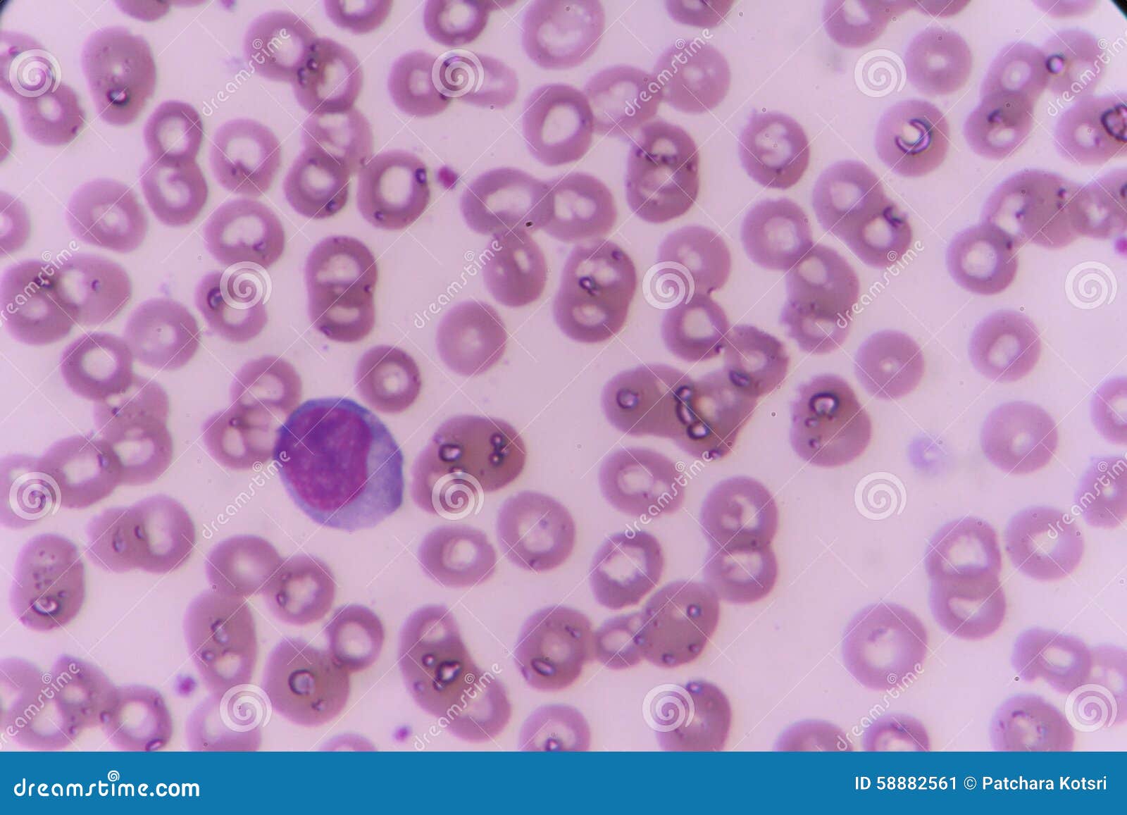 Smear In Microbiology