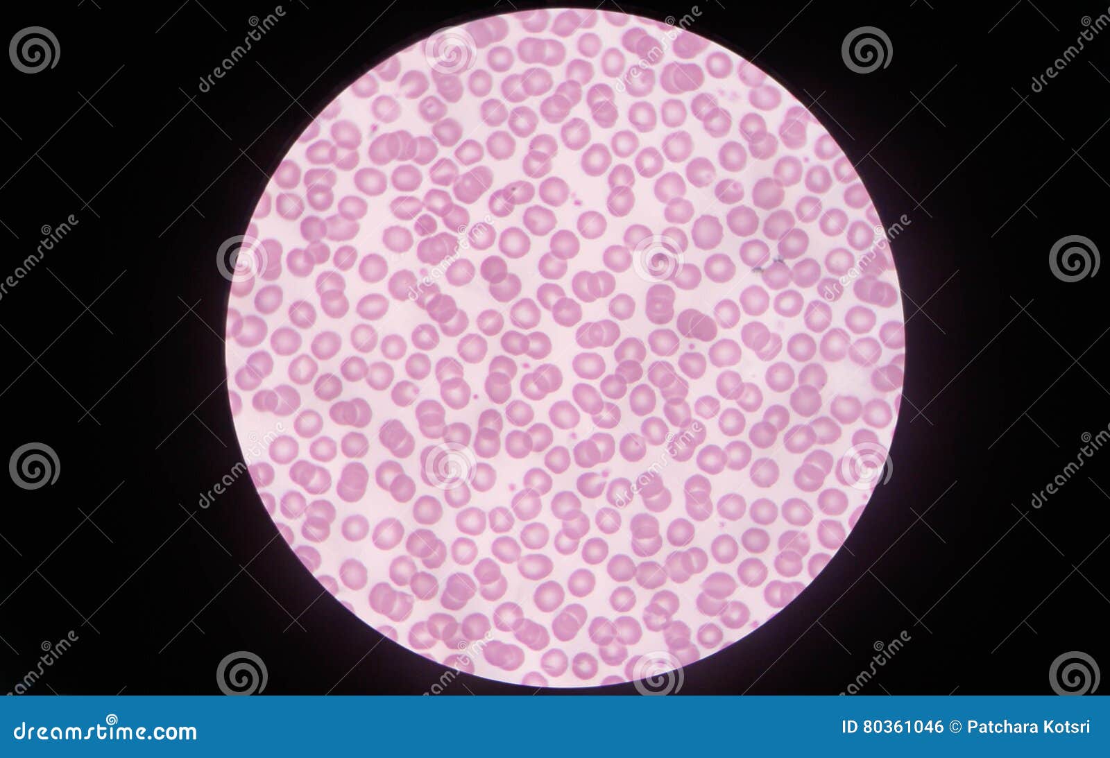 Blood smear stock photo. Image of white, therapy, blood - 80361046