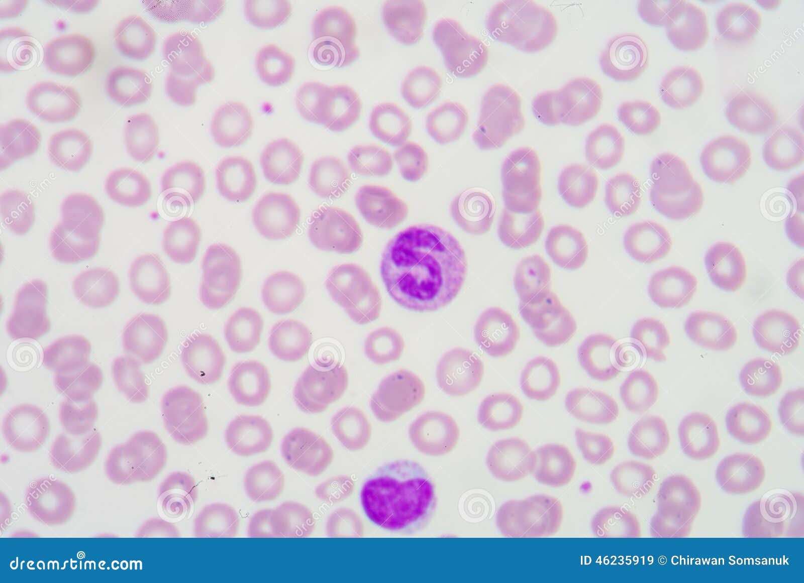 Blood smear stock image. Image of bactericidal, microbiology - 46235919