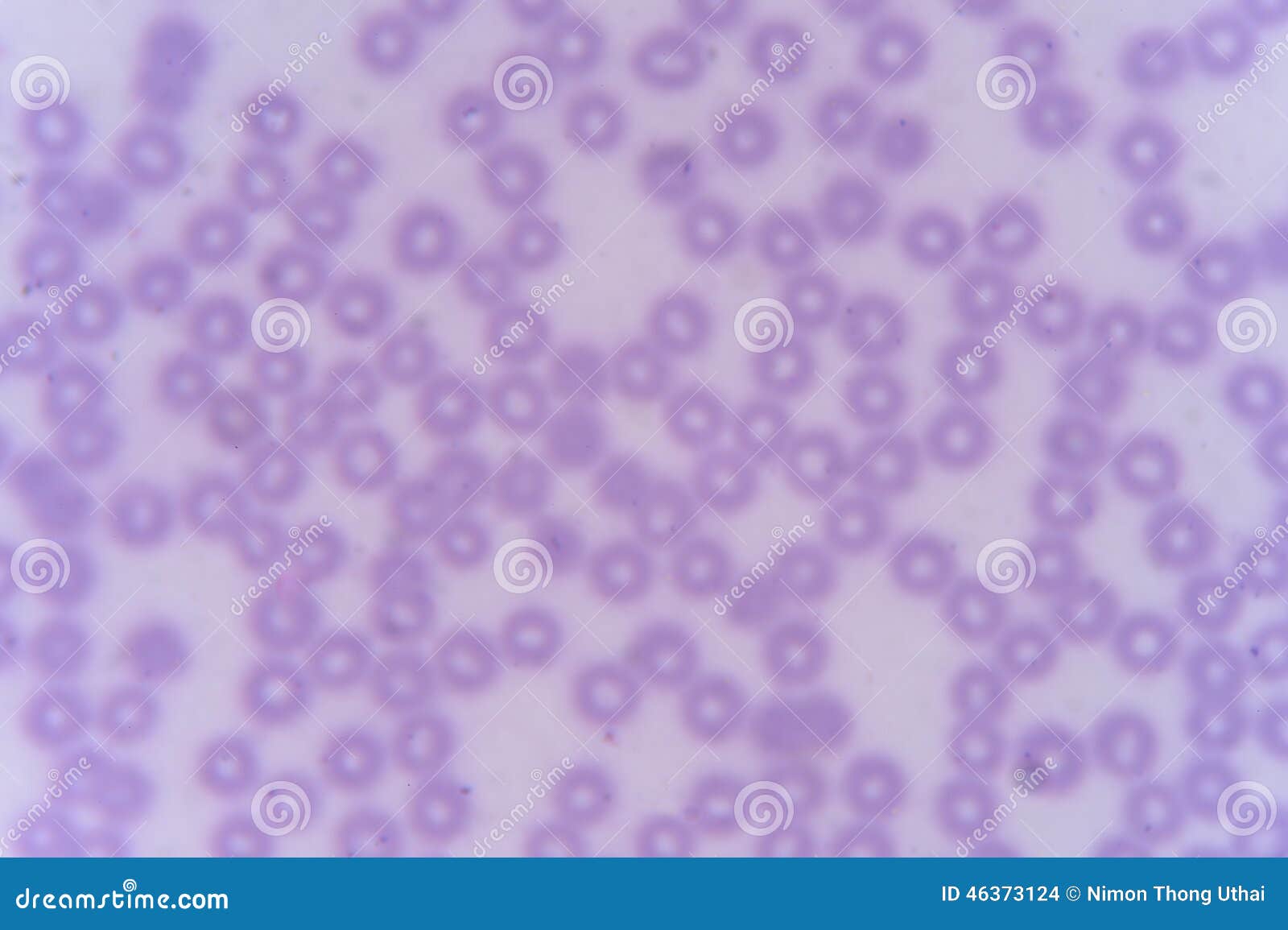 Blood Smear : Red Blood Cells Stock Photo - Image of sample, medical ...