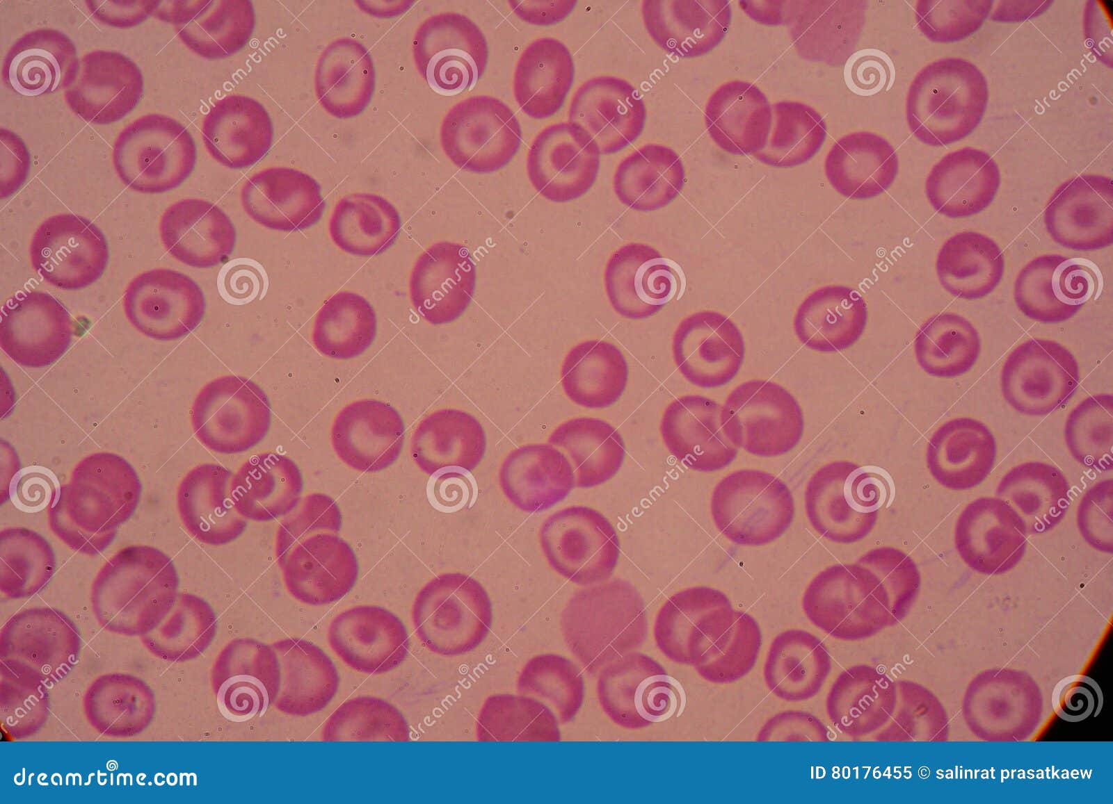 Blood Smear Showing Under Microscope Stock Image - Image of form ...