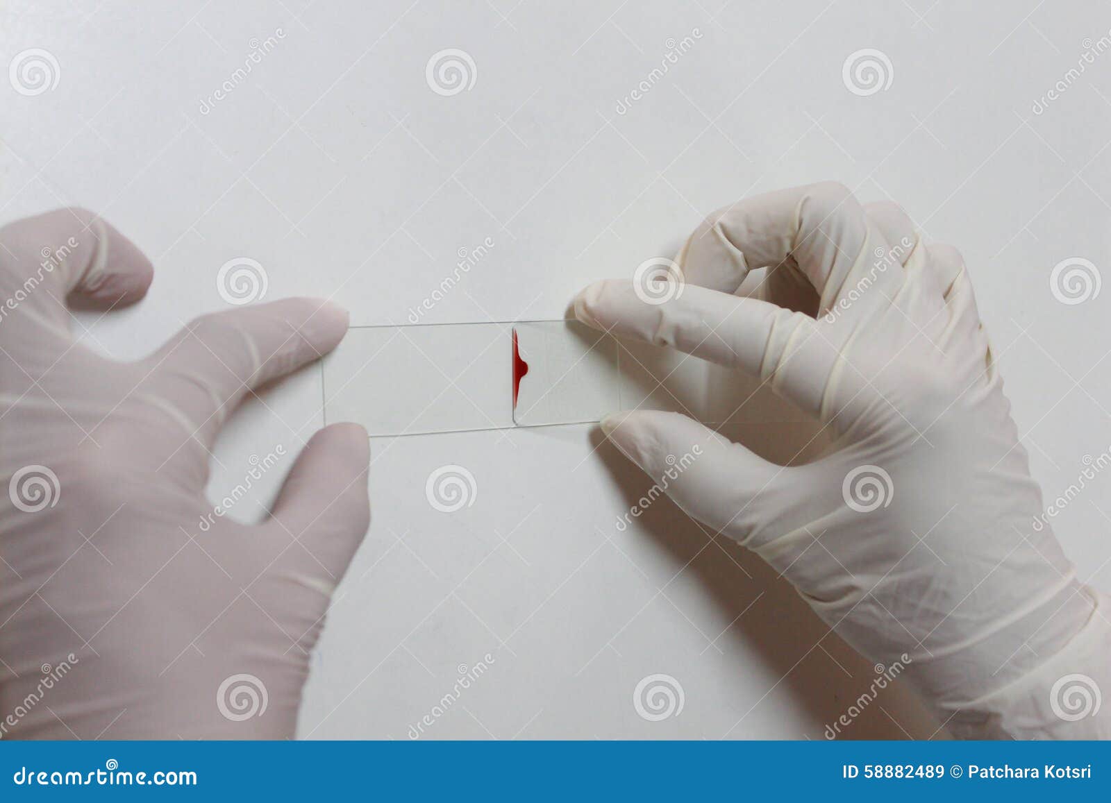 Blood smear stock image. Image of microscope, laboratory - 58882489