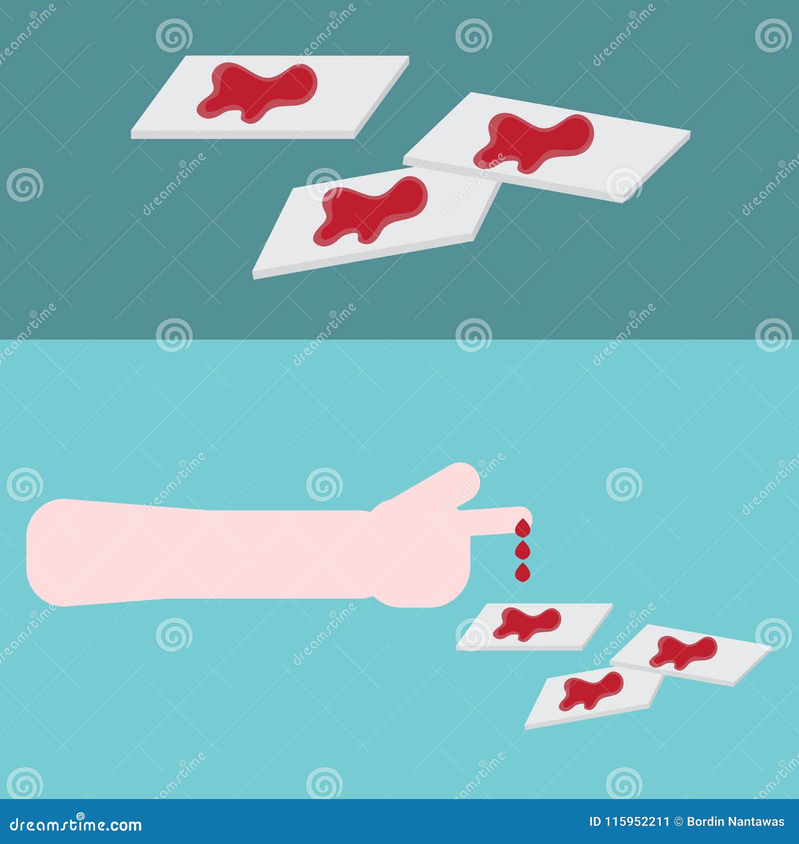 Blood Smear on the Glass Slides Stock Vector - Illustration of ...