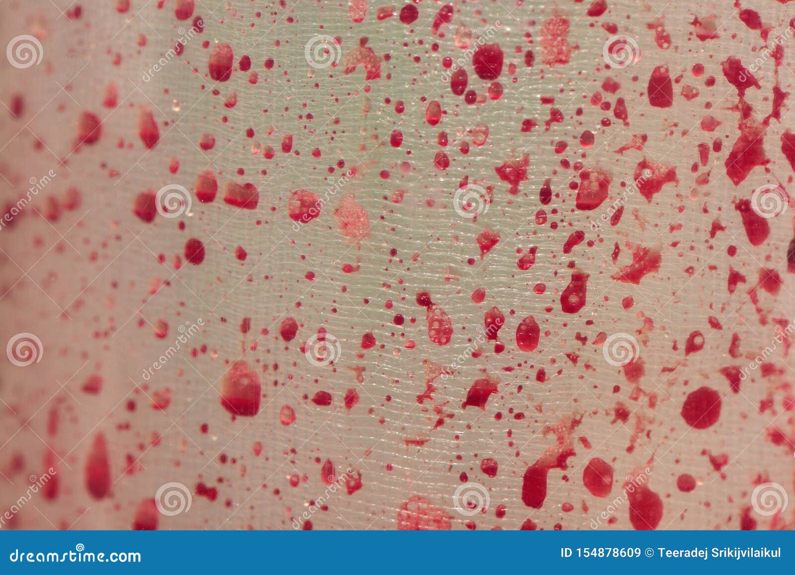 Blood Stained on Suction Container in Operating Room Stock Image ...