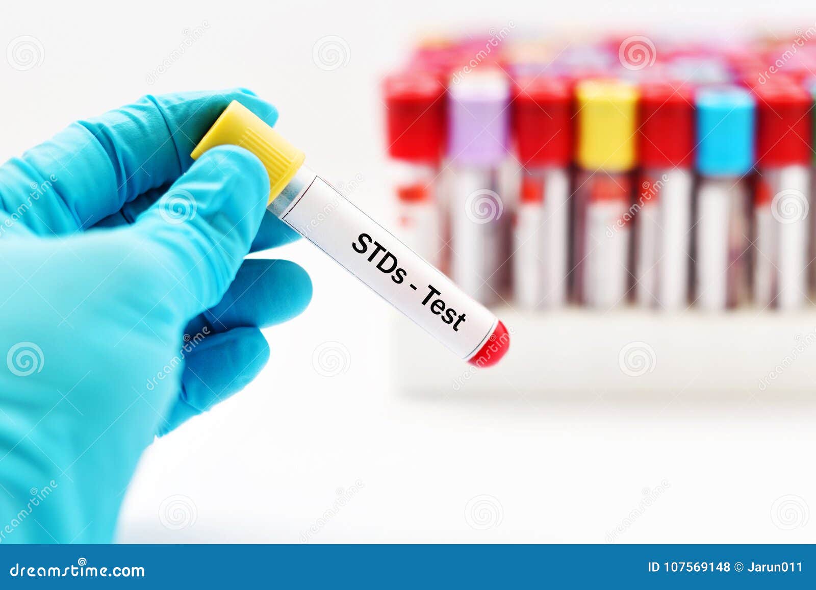 Blood for STD test stock photo. Image of herpes, fever - 107569148