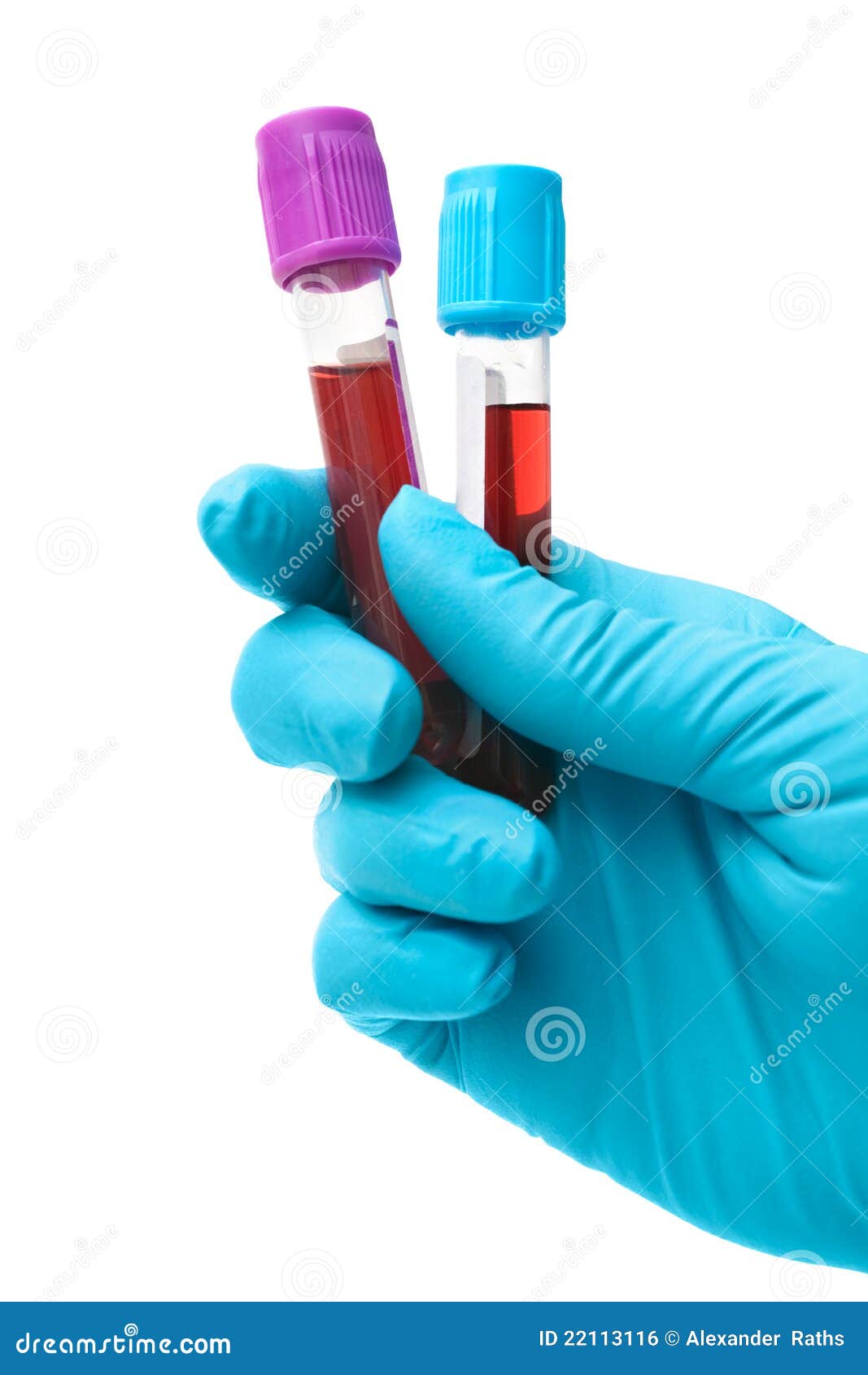 Blood test stock photo. Image of experiment, doctor, laboratory - 22113116
