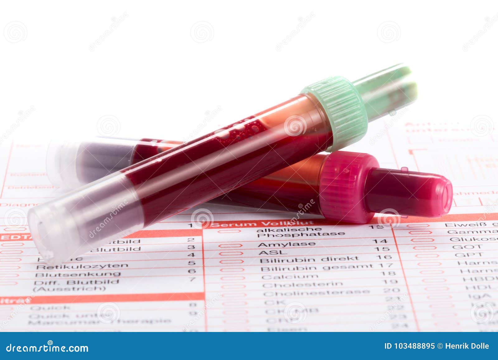 Blood Test, Blood Samples on a Laboratory Form Stock Image - Image of ...
