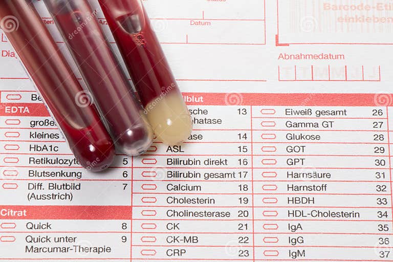 Blood Test, Blood Samples on a Laboratory Form Stock Photo - Image of ...