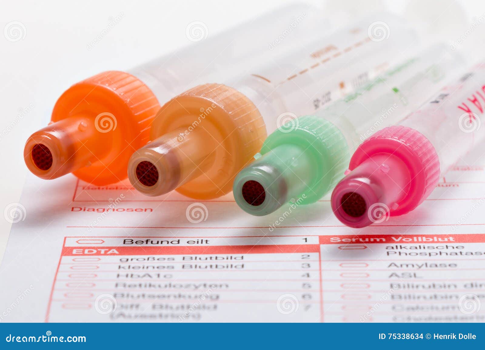 Blood Test, Blood Samples on a Laboratory Form Stock Photo - Image of ...