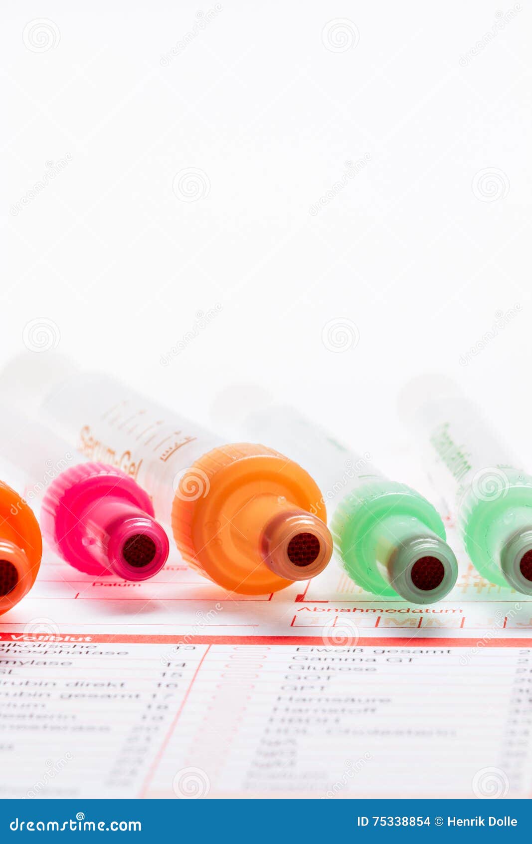 Blood Test, Blood Samples on a Laboratory Form Stock Photo - Image of ...