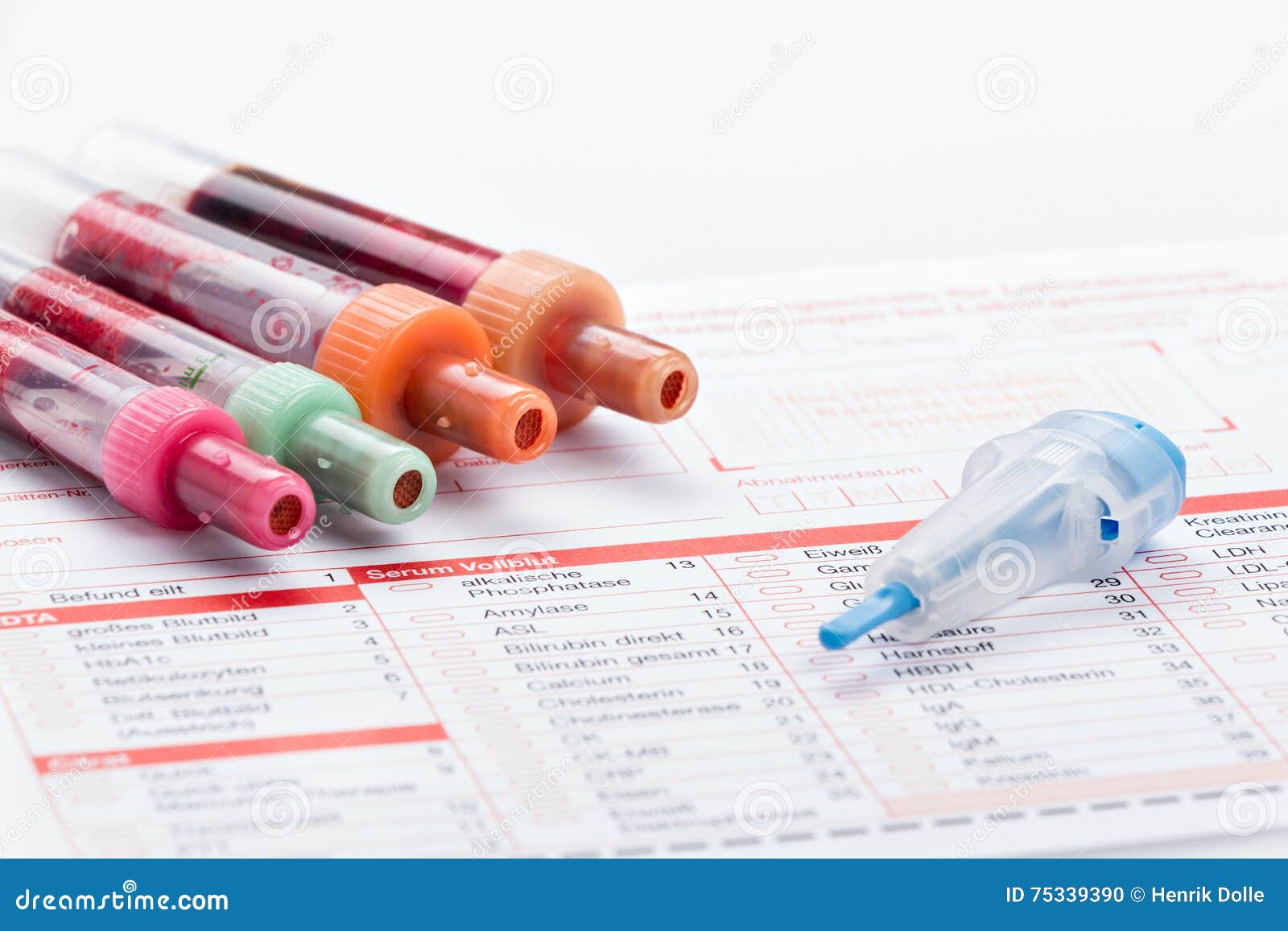 Blood Test, Blood Samples on a Laboratory Form Stock Photo - Image of ...