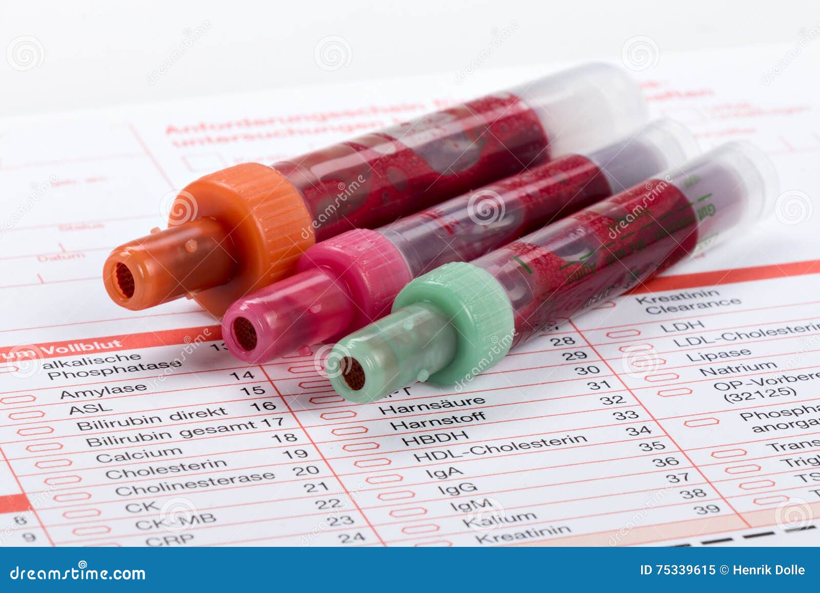 Blood Test, Blood Samples on a Laboratory Form Stock Image - Image of ...