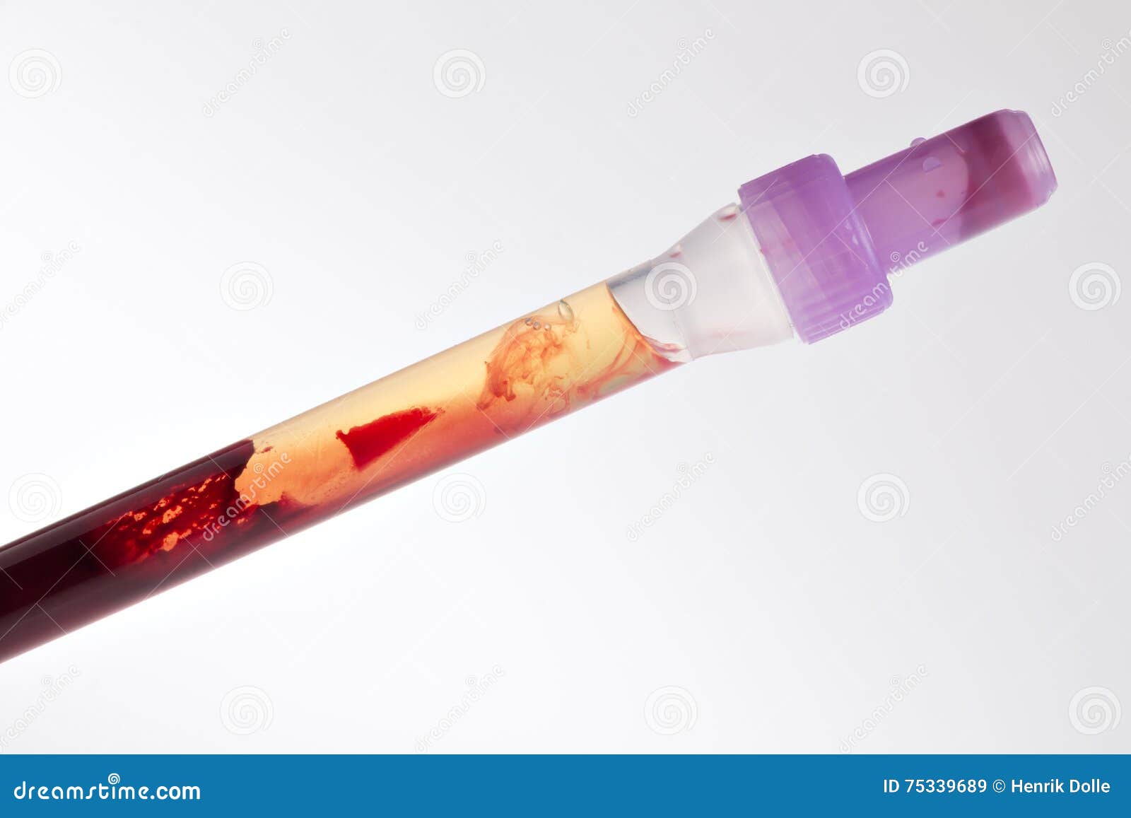 Blood Test, Blood Samples on a Laboratory Form Stock Image - Image of ...