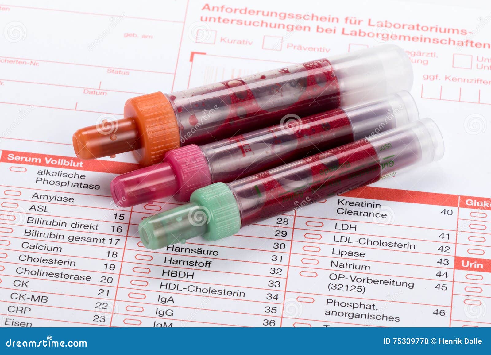 Blood Test, Blood Samples on a Laboratory Form Stock Photo - Image of ...