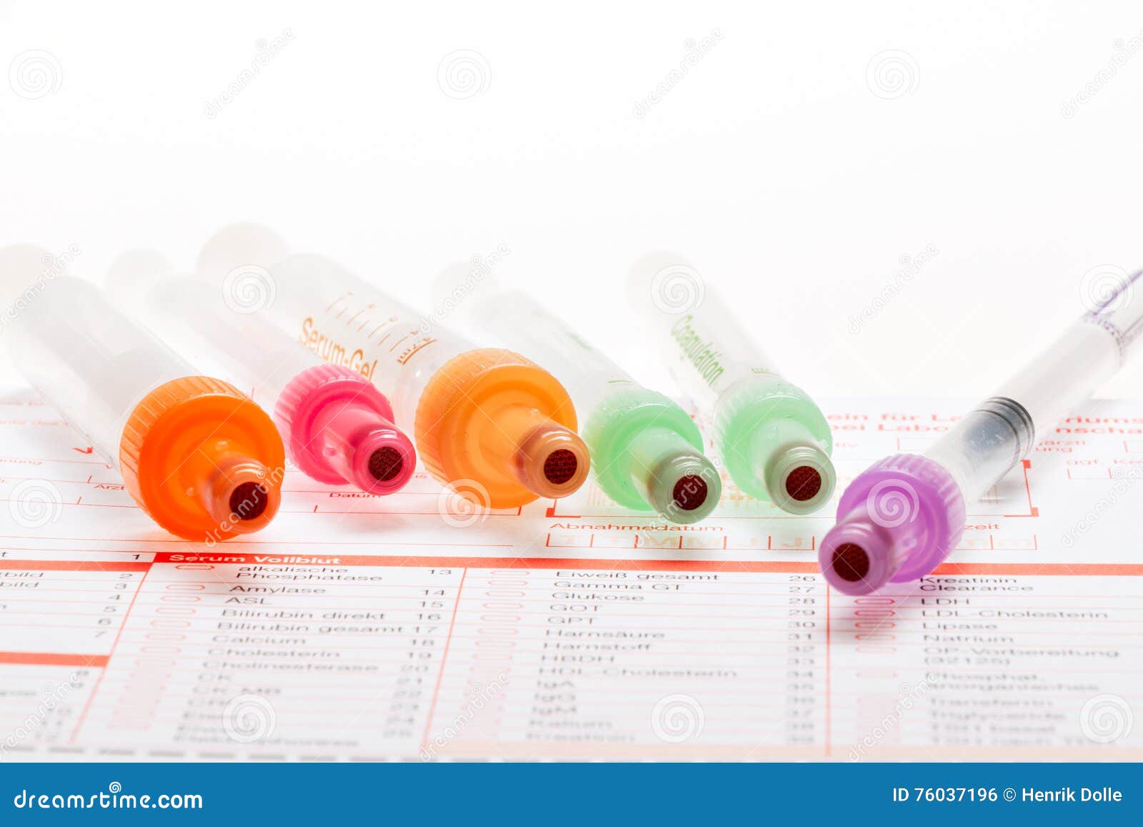 Blood Test, Blood Samples on a Laboratory Form Stock Photo - Image of ...