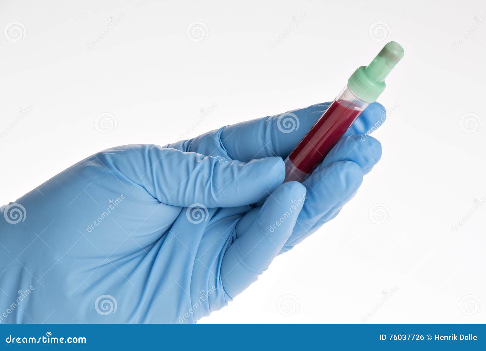 Blood Test, Blood Samples on a Laboratory Form Stock Photo - Image of ...