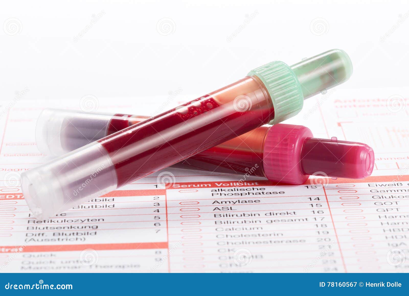 Blood Test, Blood Samples on a Laboratory Form Stock Image - Image of ...