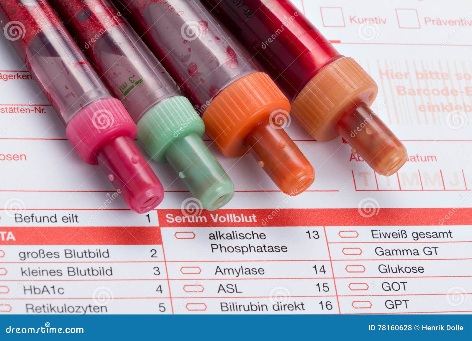 Blood Test, Blood Samples on a Laboratory Form Stock Photo - Image of ...