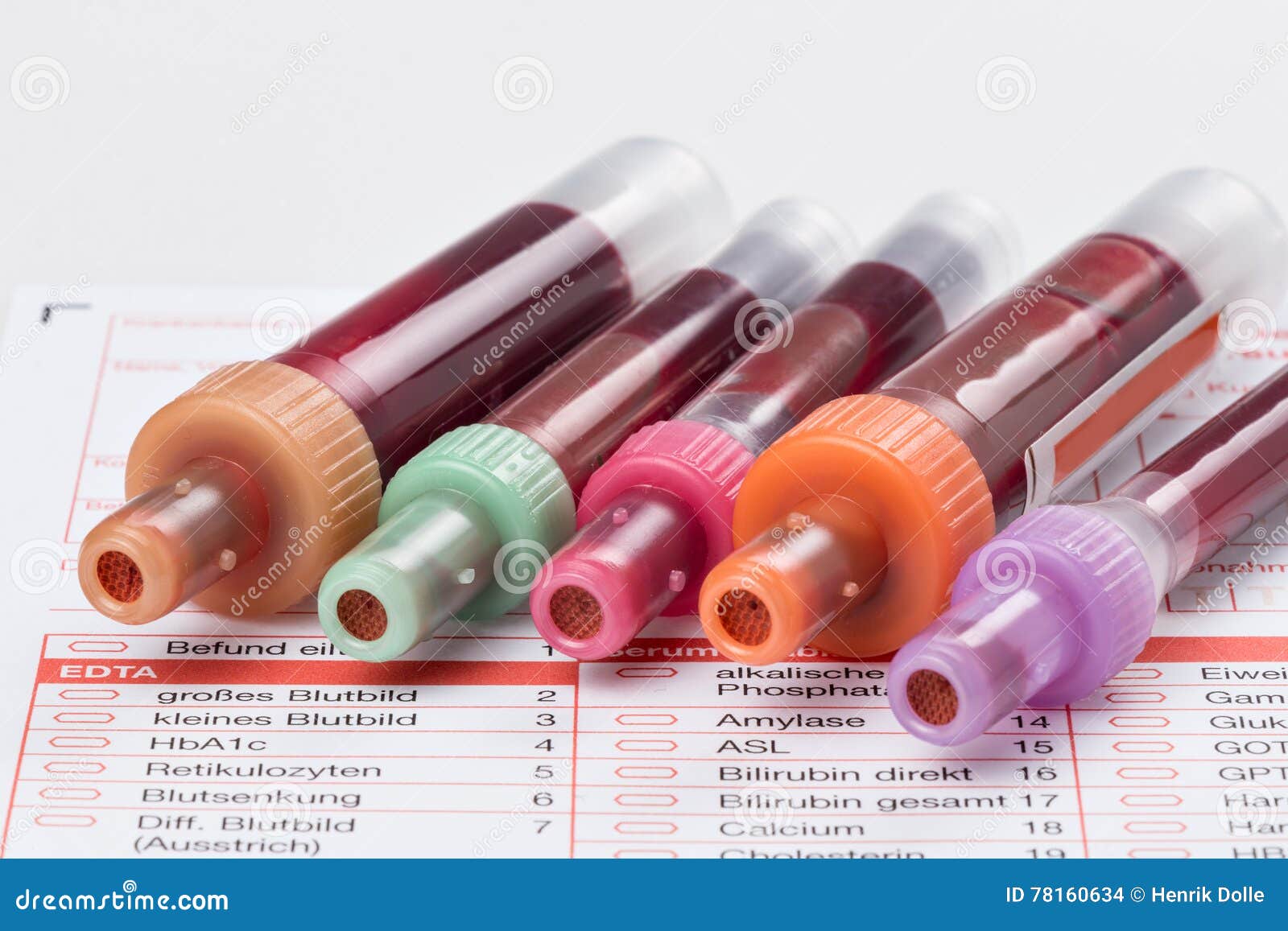 Blood Test, Blood Samples on a Laboratory Form Stock Photo - Image of ...