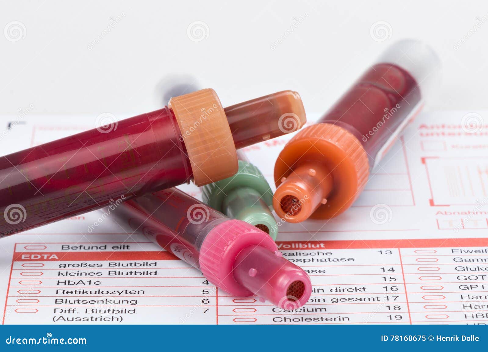 Blood Test, Blood Samples on a Laboratory Form Stock Image - Image of ...