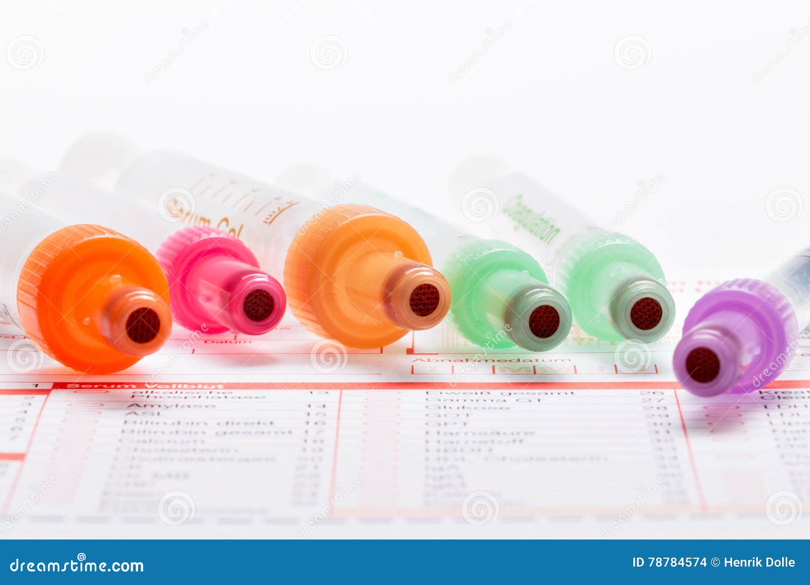 Blood Test, Blood Samples on a Laboratory Form Stock Photo - Image of ...