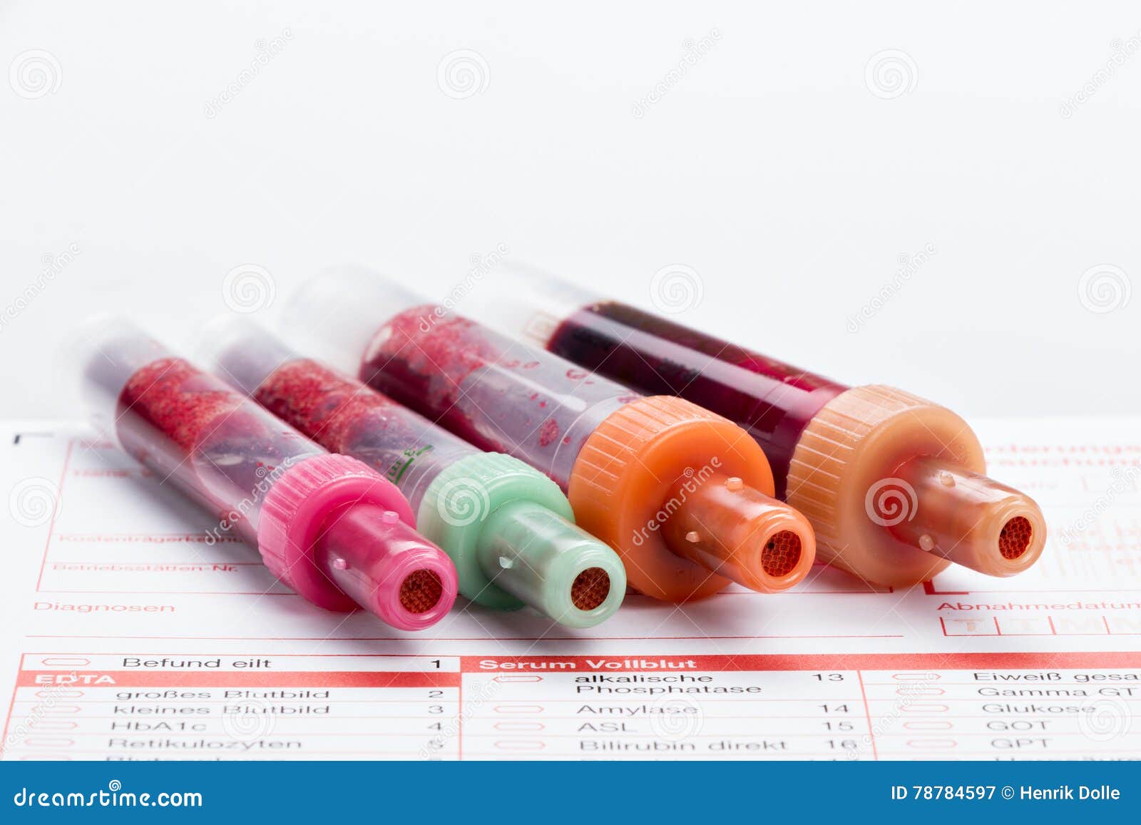 Blood Test, Blood Samples on a Laboratory Form Stock Image - Image of ...