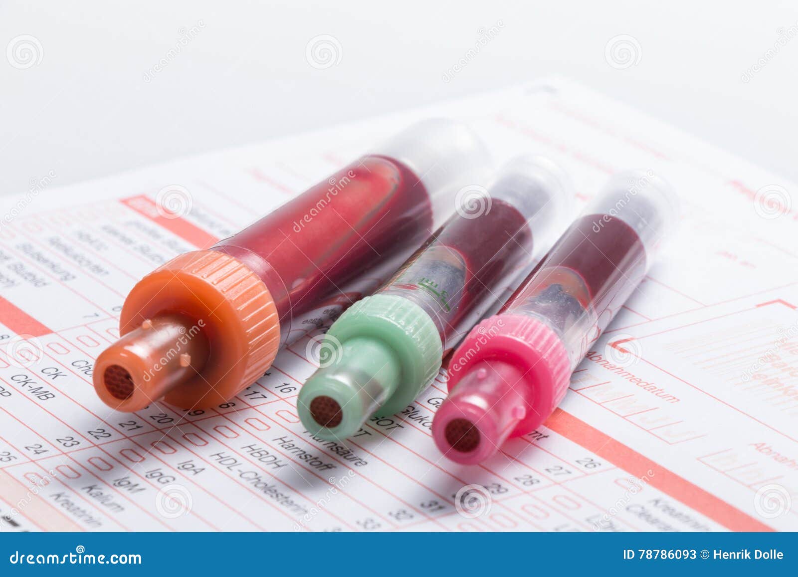 Blood Test, Blood Samples on a Laboratory Form Stock Image - Image of ...