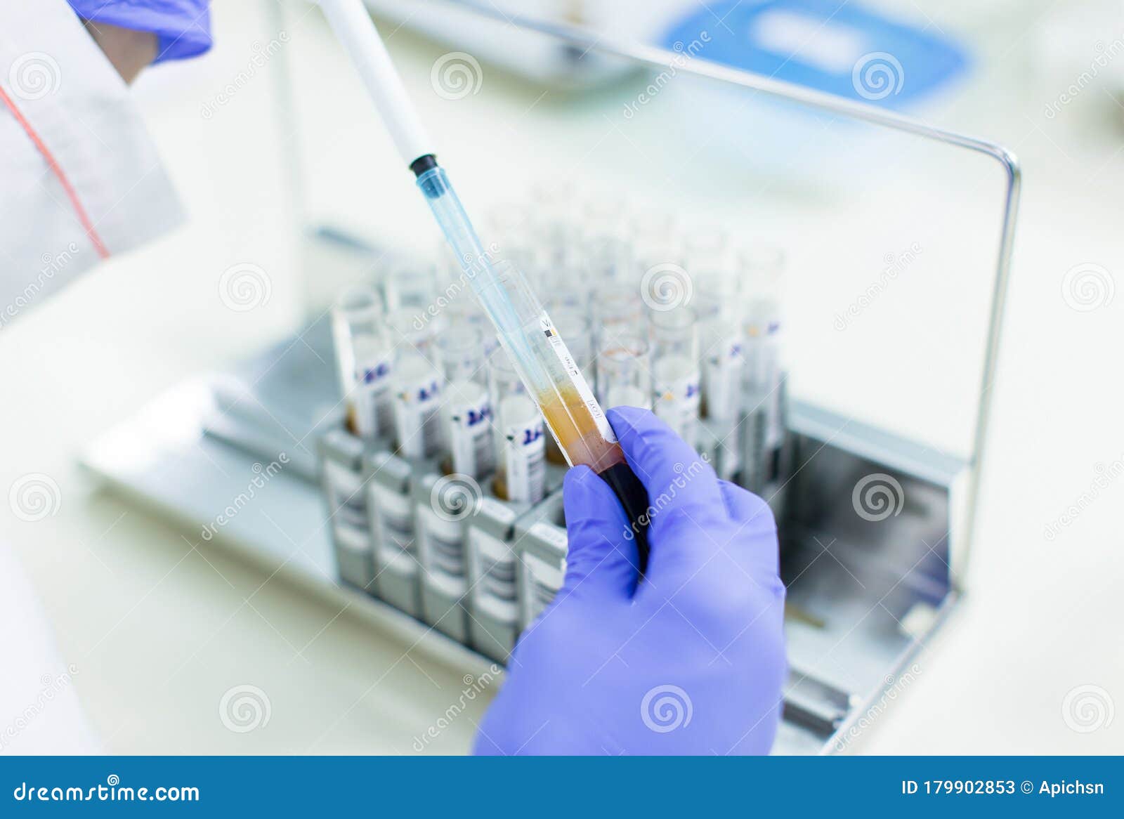 The blood test stock image. Image of plasma, equipment - 179902853