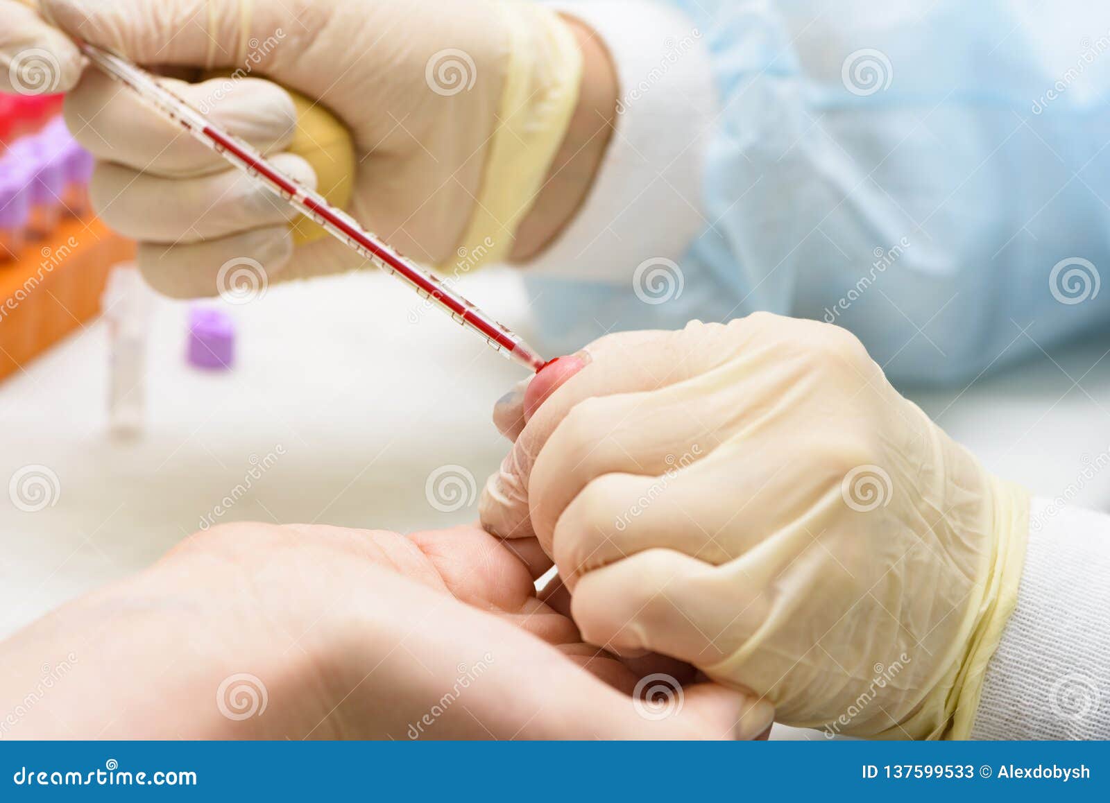Blood Test from Finger stock image. Image of test, drop - 137599533