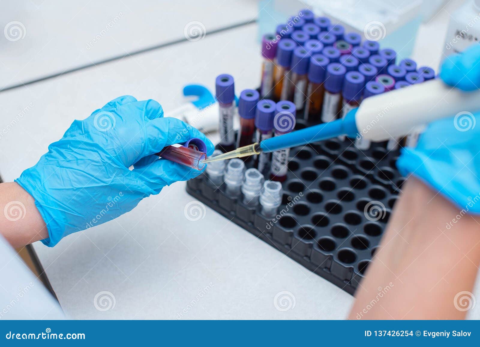 Blood Test in the Laboratory. Laboratory Assistant Working with the ...