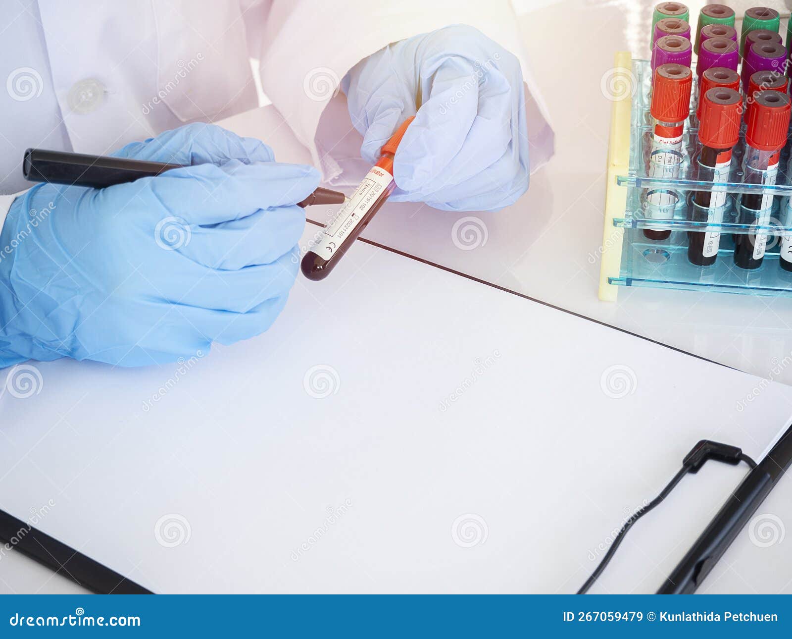 Blood Test in the Laboratory. Laboratory Assistant Working with the ...