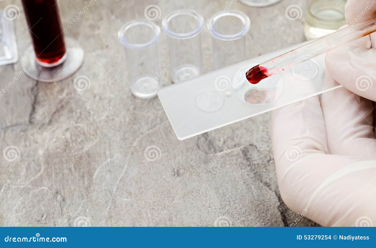 Blood test stock photo. Image of cell, dish, microbiology - 53279254