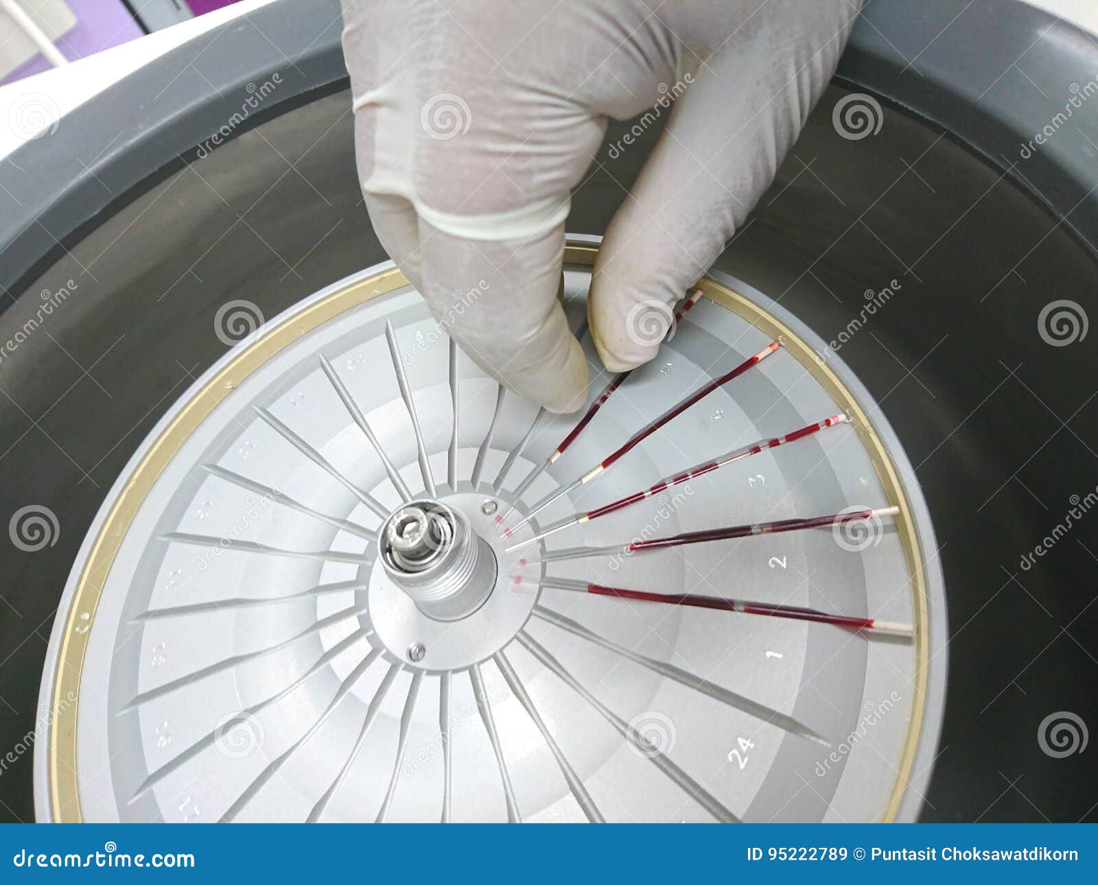 Blood test machine stock image. Image of contamination - 95222789