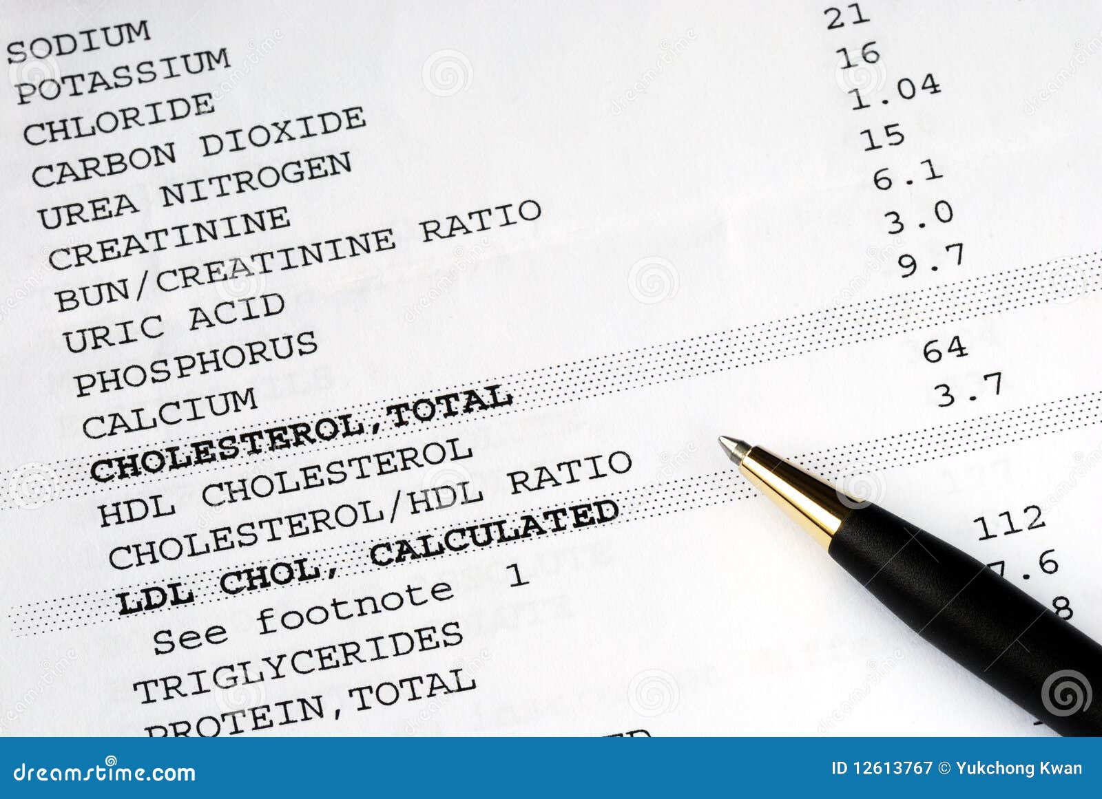 Blood test result stock image. Image of equipment, count - 12613767