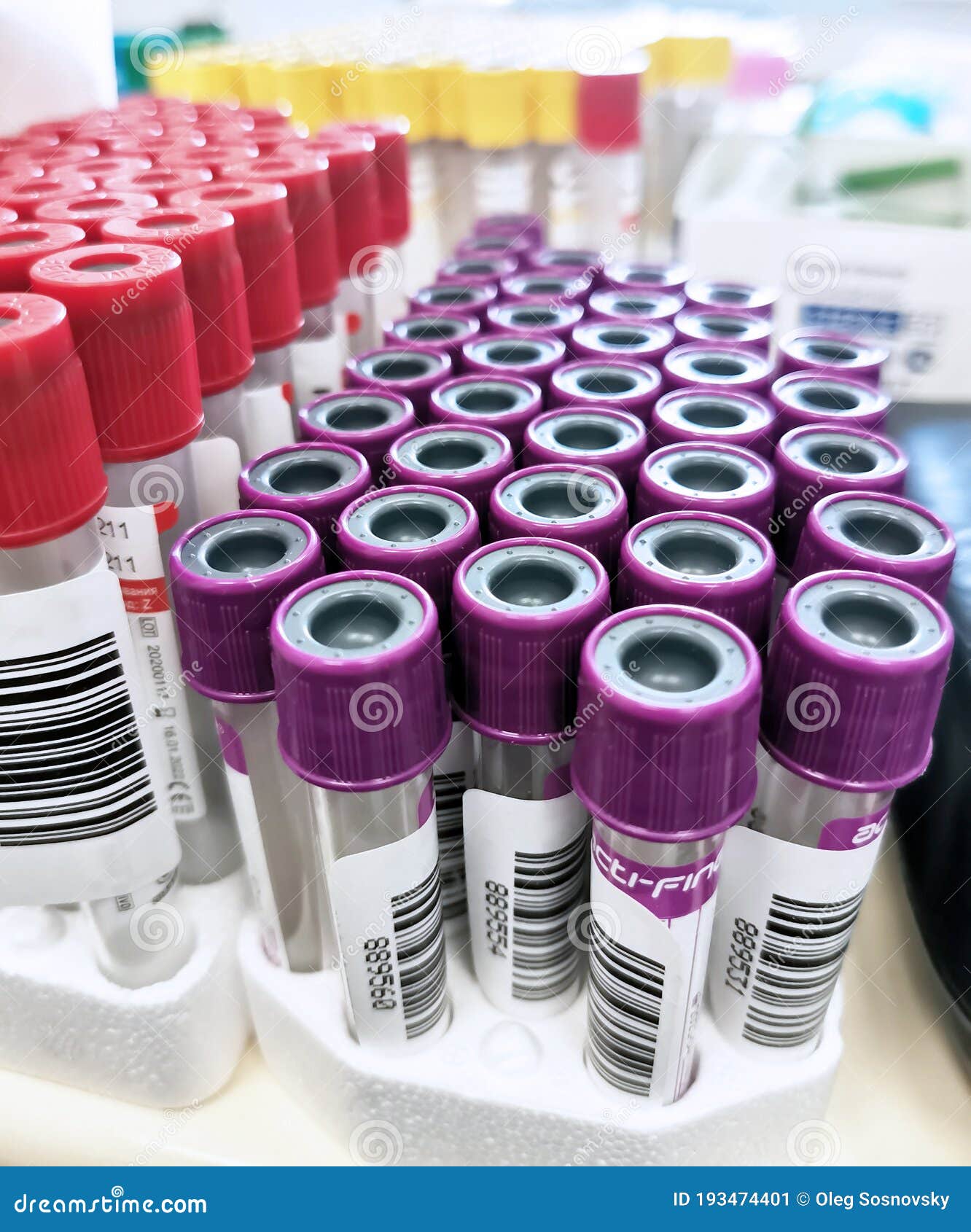 Blood Test Room. Taking Blood Editorial Photo - Image of cure, medical ...