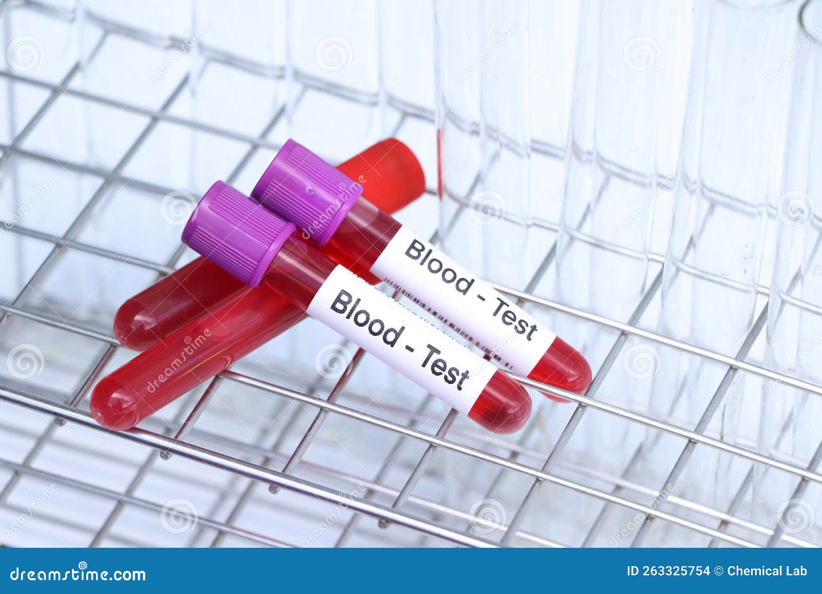 Blood Test To Look for Abnormalities from Blood, Blood Sample To ...