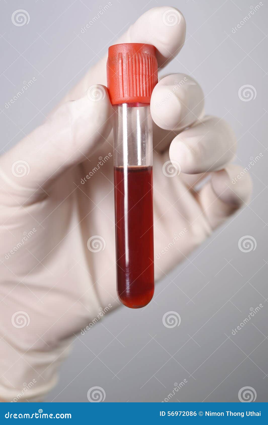 Blood Test Tube in a Laboratory Stock Photo - Image of blood, package ...