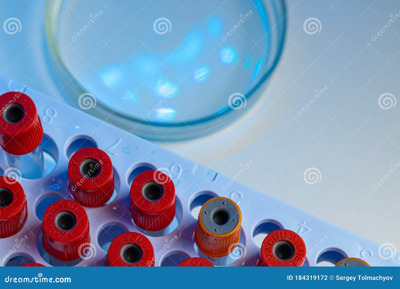 Blood Test Tubes in Lab Close Up Stock Photo - Image of science, health ...