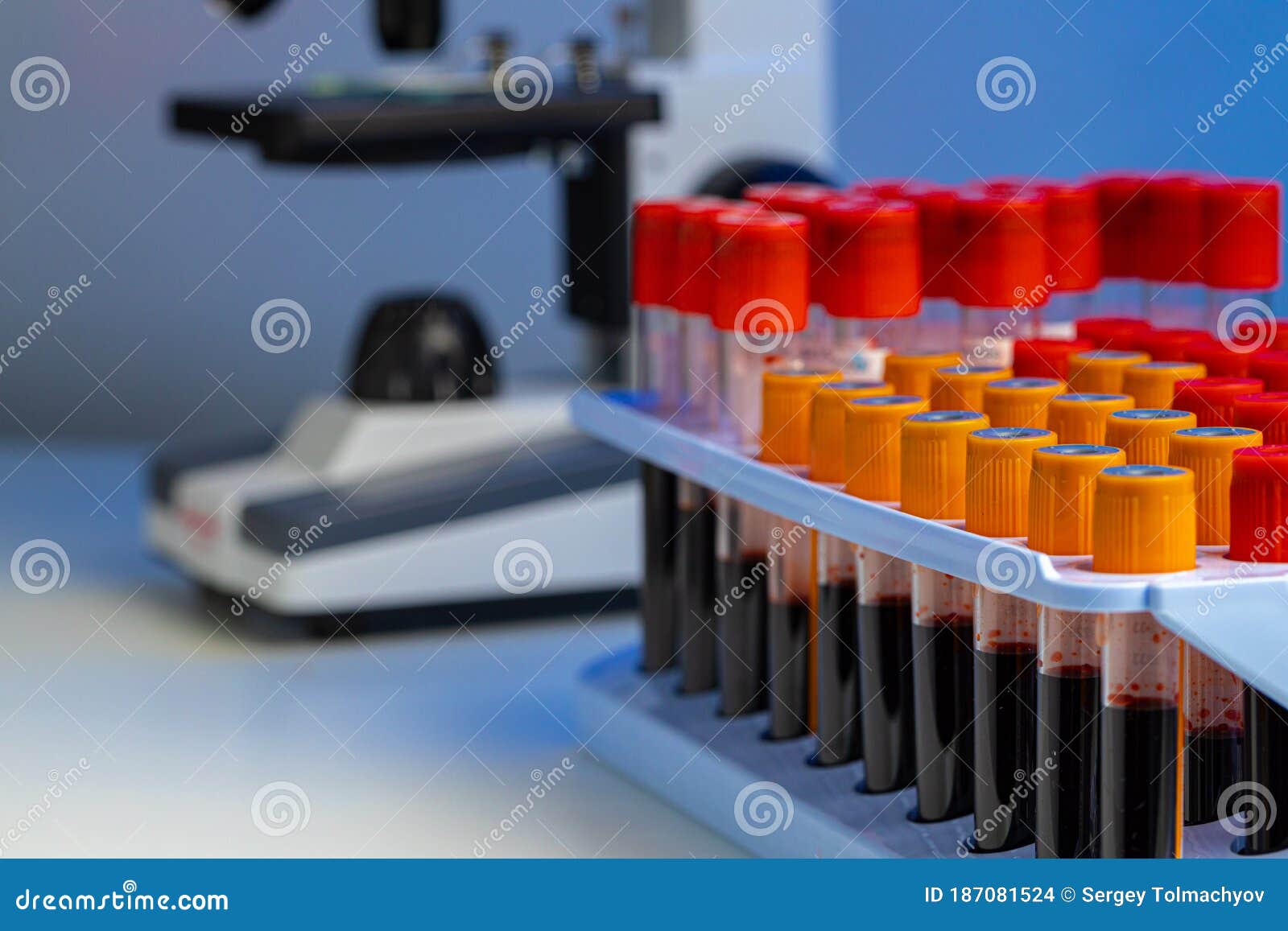 Blood Test Tubes in Lab Close Up Stock Photo - Image of chemical ...