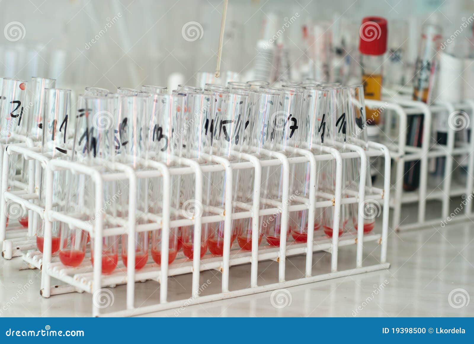 Blood in Test Tubes in Real Lab Stock Photo - Image of medical ...